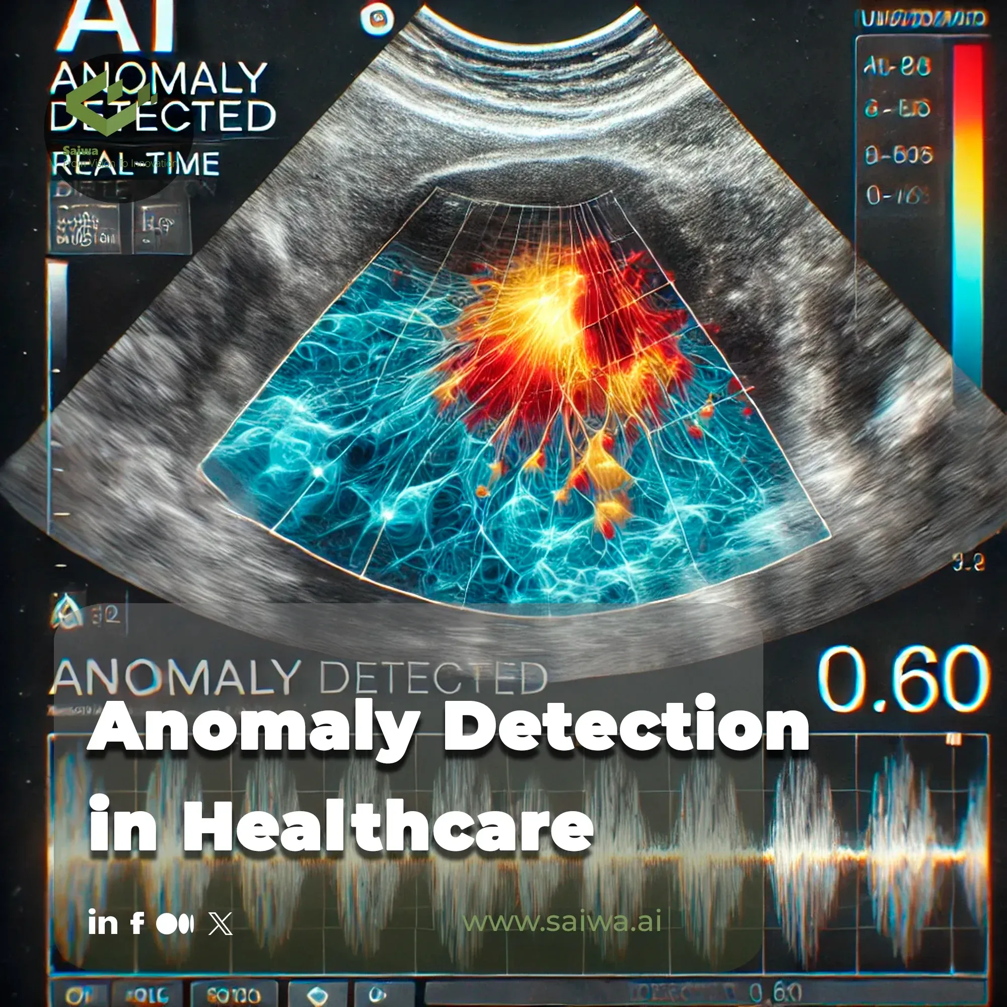 Anomaly Detection in Healthcare | Improving Patient Safety